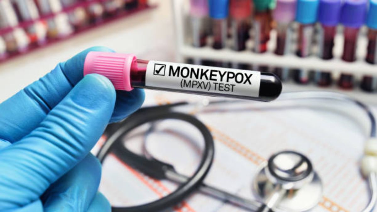 Suspected Mpox Case Under Investigation; Patient Isolated, No Cause for ...